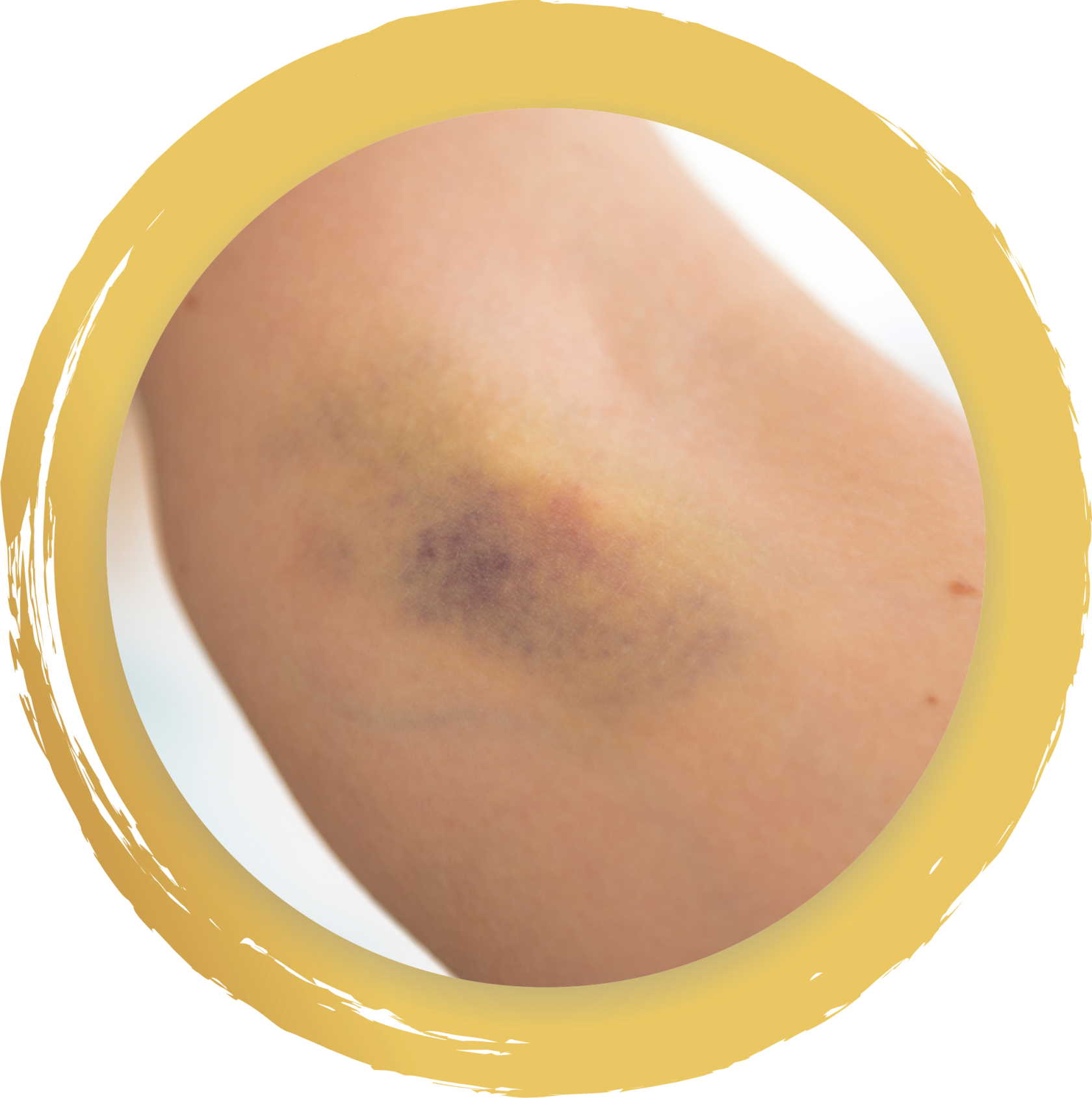 Lek homeopatyczny Arnigel żel z arniką na siniaki, stłuczenia i urazy ...